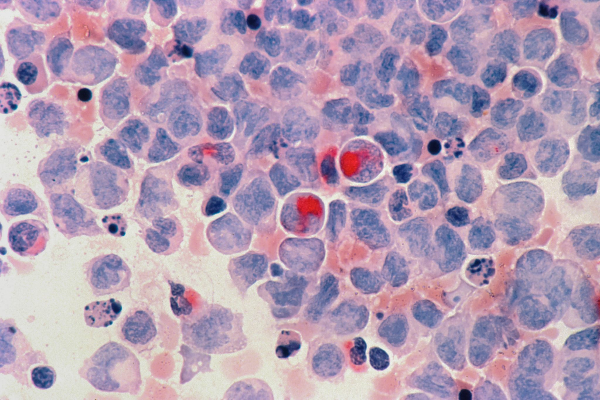 Lysosome and Autophagy: How Cells Break Down Waste